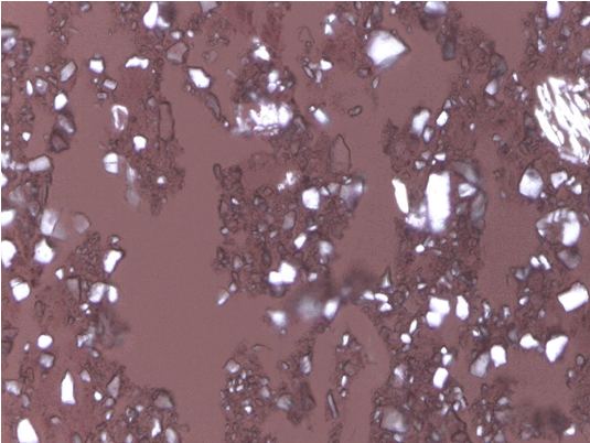 FULL TEXT - Barium-induced allergic appendicitis: A case report ...